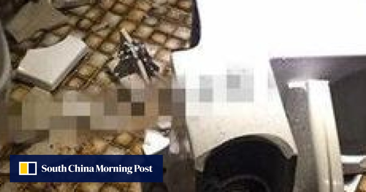 Exploding toilet leaves woman suffering 7cm gash at karaoke bar in ...