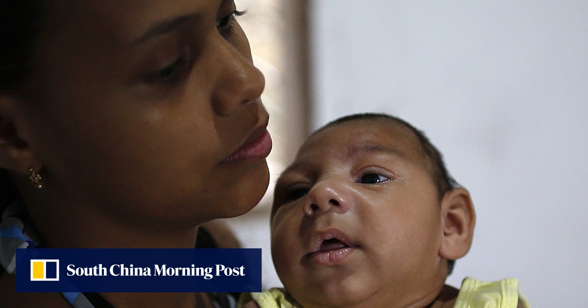 Study may have found link between Zika virus and microcephaly in babies ...