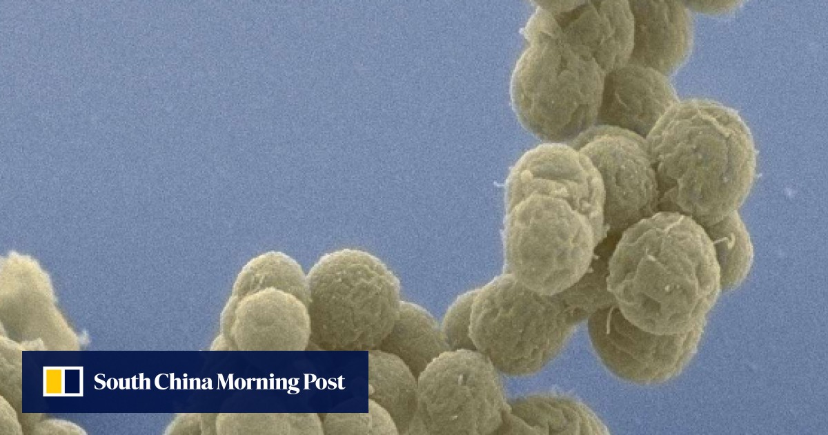 Life in miniature: scientists whittle away genes from bacteria to ...