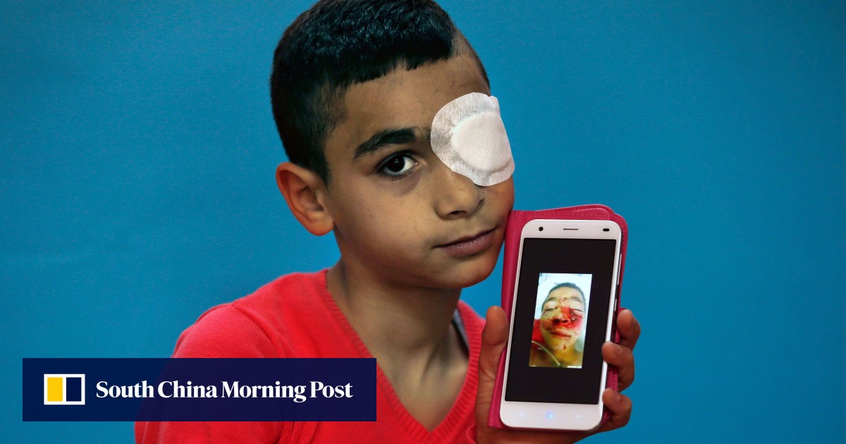 Israeli sponge-tipped bullets hit hard and leave painful legacy for ...