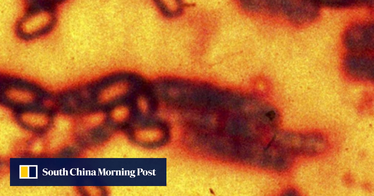 Hundreds of safety incidents with bioterror germs reported by secretive ...