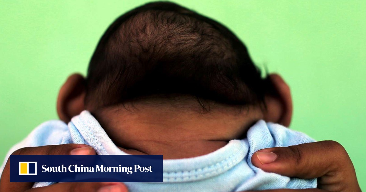 Thailand confirms 2 cases of Zika-linked microcephaly, first in region ...