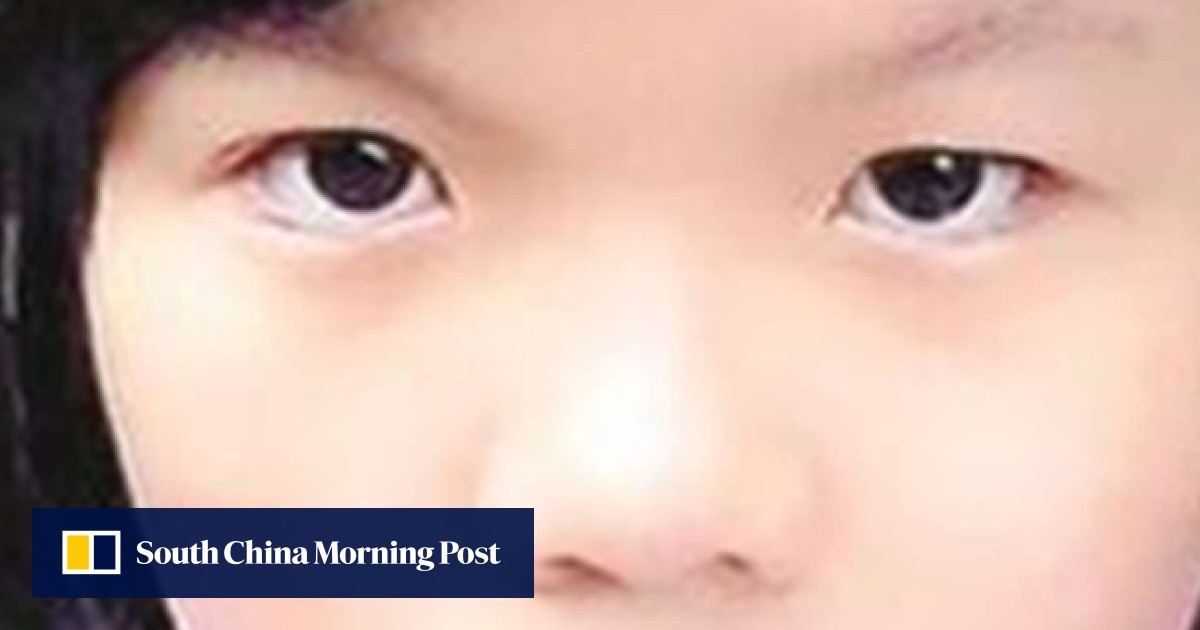 Chinese girl, 14, suffers horrific burns trying to rescue father from ...