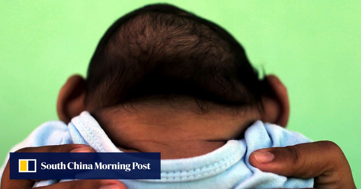 Serious birth defects afflict one in 10 Zika pregnancies, shocking new ...