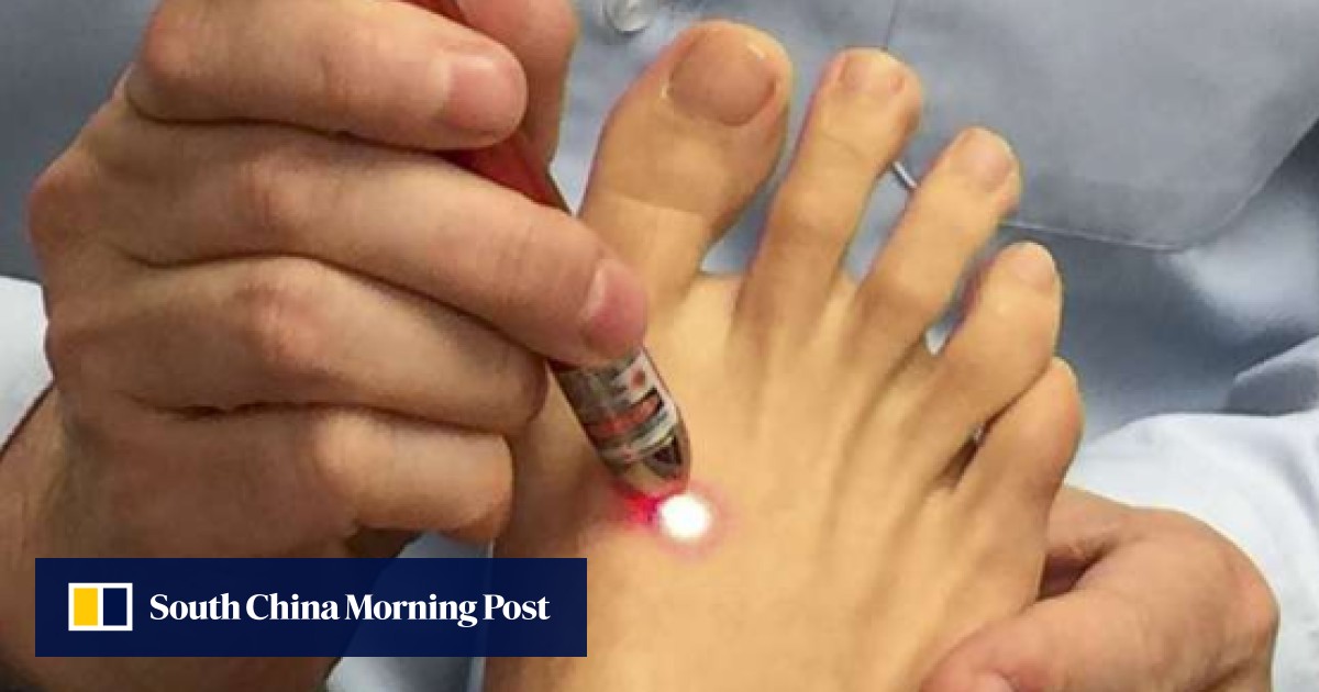 Electrical testing and acupuncture without needles: is there a point ...