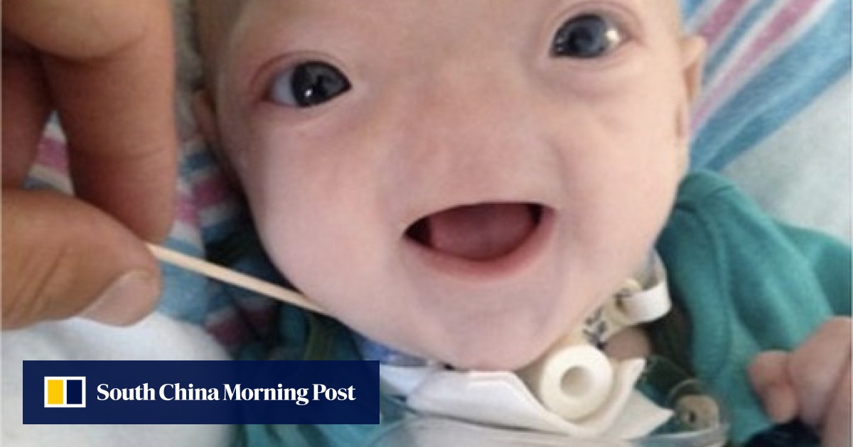 Little Eli Thompson, born without a nose, dies aged 2 | South China ...