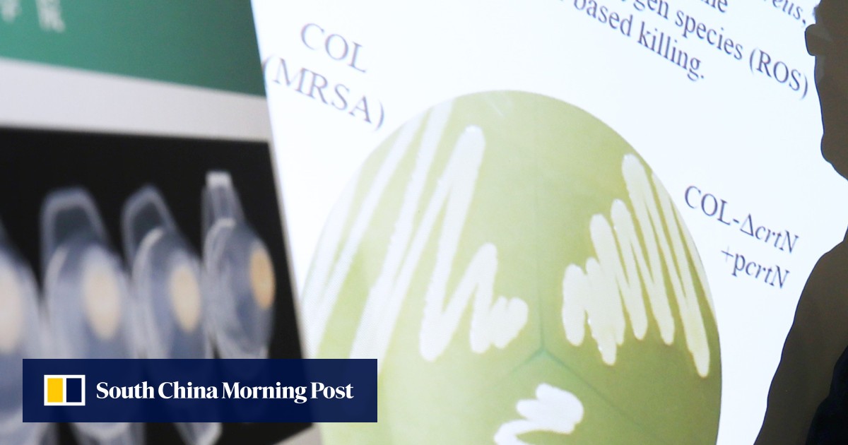 Superbug breakthrough by HKU researchers in fight against drug ...
