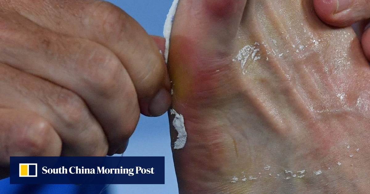 Blisters cut Chung Hyeon’s fairy-tale Australian Open run short as ...