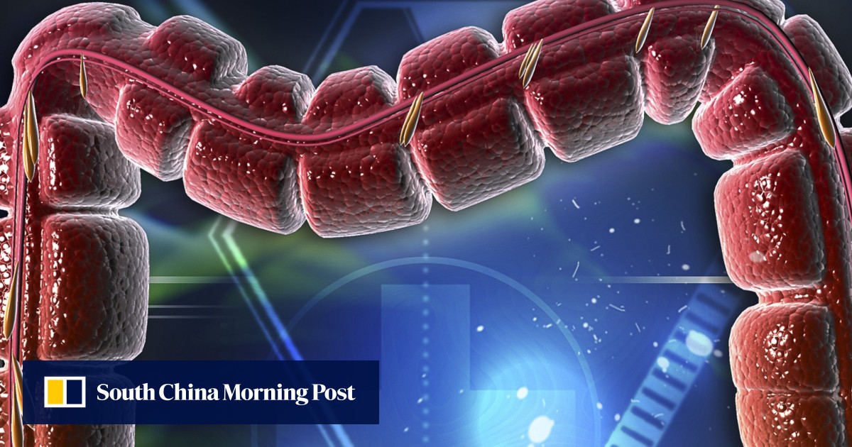 Why the microbes in your poo could one day help people to lose weight ...