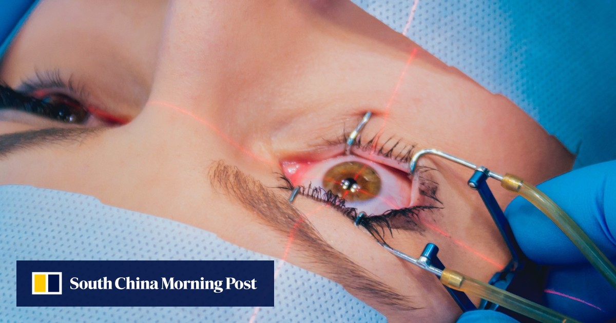 Ai Algorithm That Detects Over 50 Diseases From An Eye Scan Beating