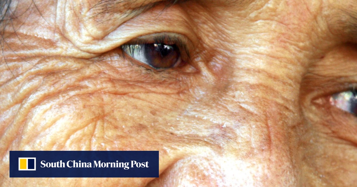 Scientists find genetic signatures of accelerated ageing by analysing ...