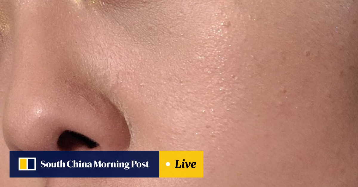 flaky foundation on cheeks