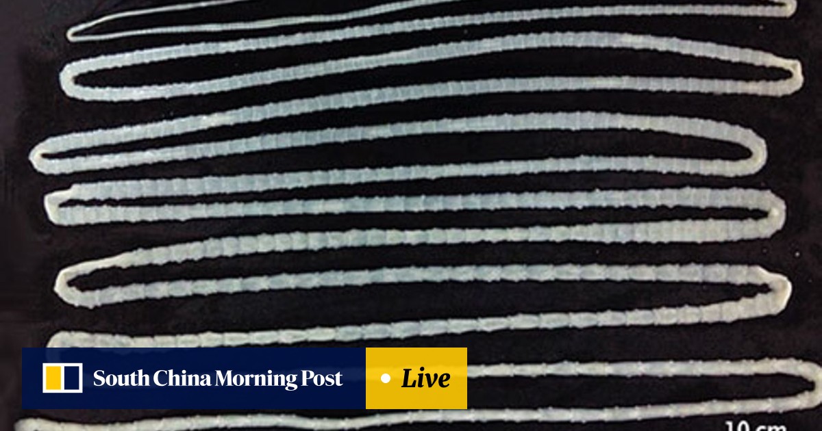 longest ever tapeworm