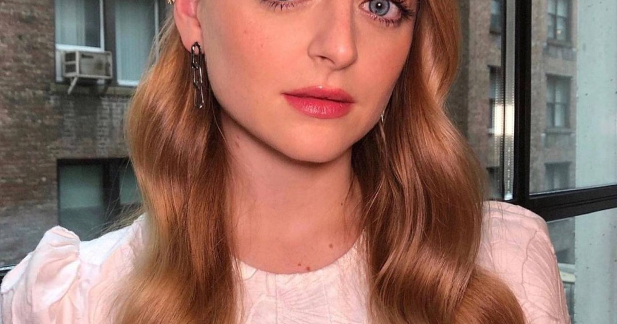 anna baryshnikov teeth