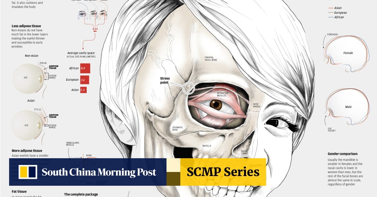 asian skull features