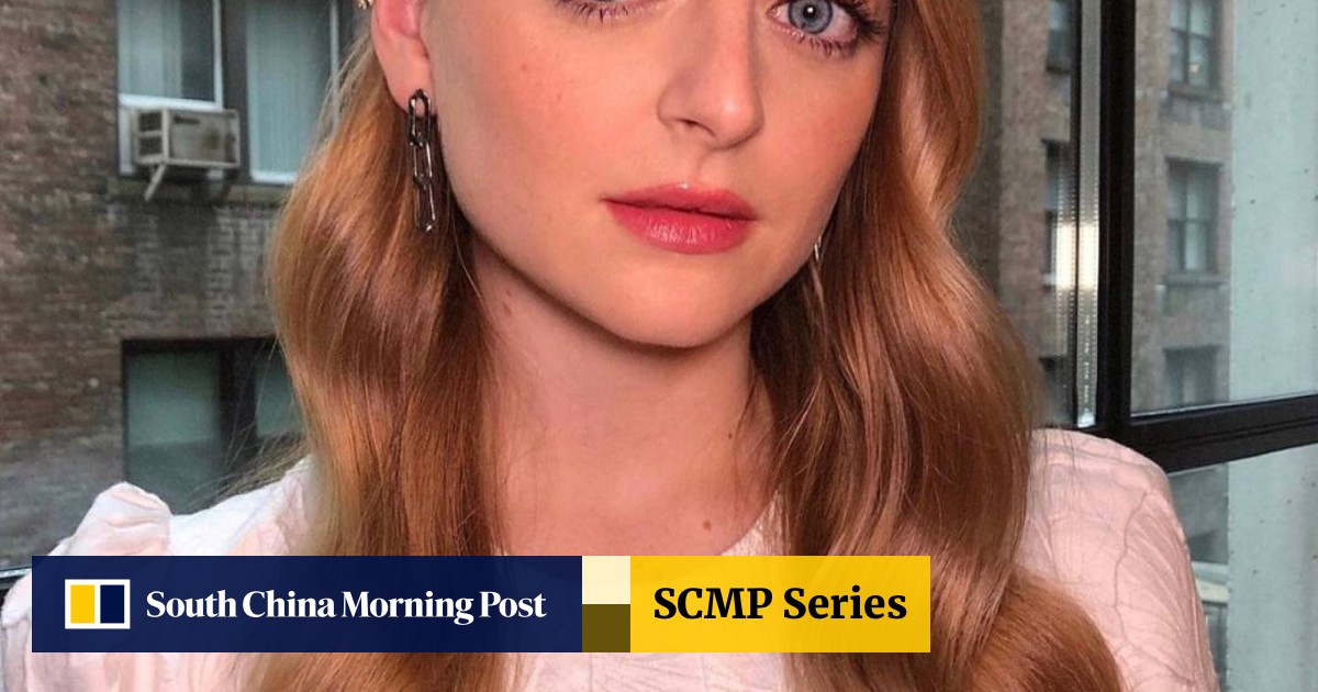 anna baryshnikov teeth