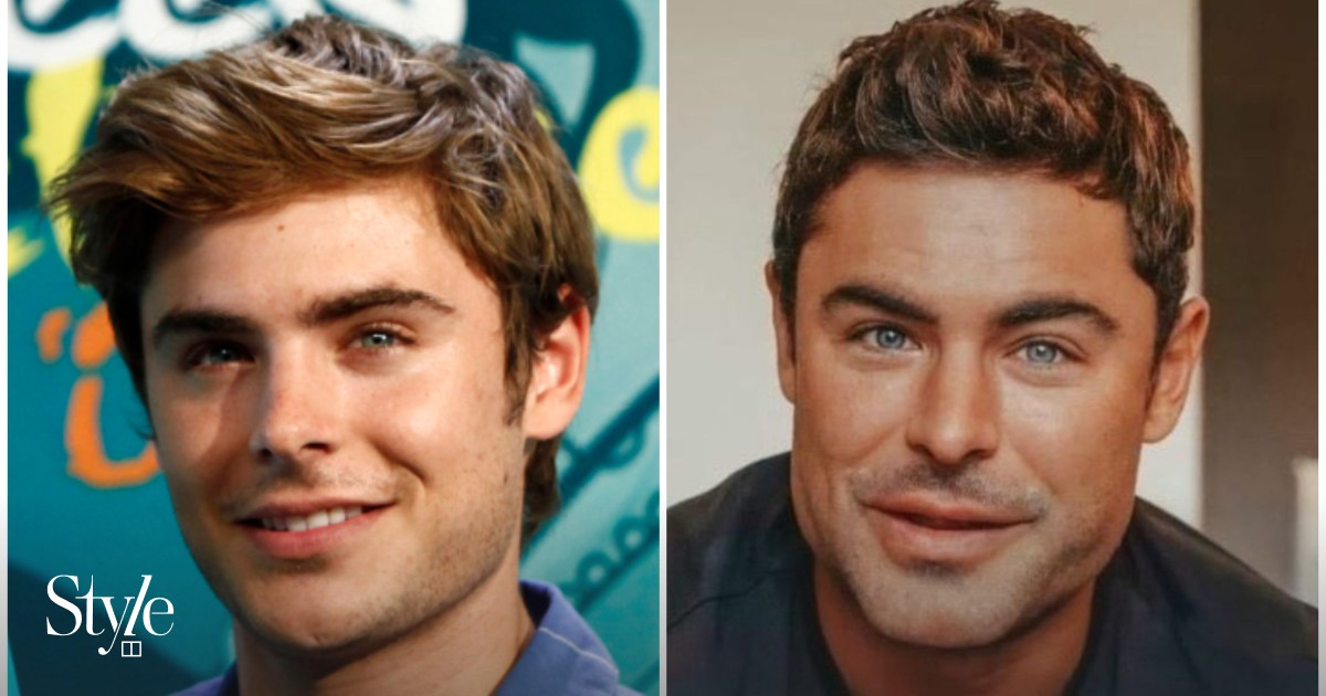 What happened to Zac Efron’s jaw? The Iron Claw actor just set the ...