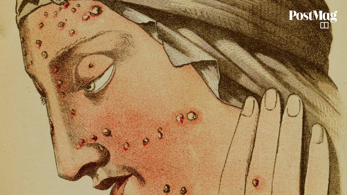 Language Matters | Where the word pox comes from, its derivatives ...