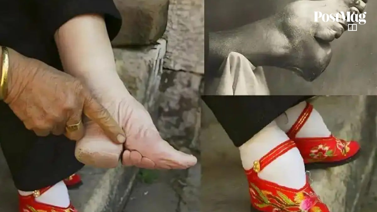 foot binding procedure