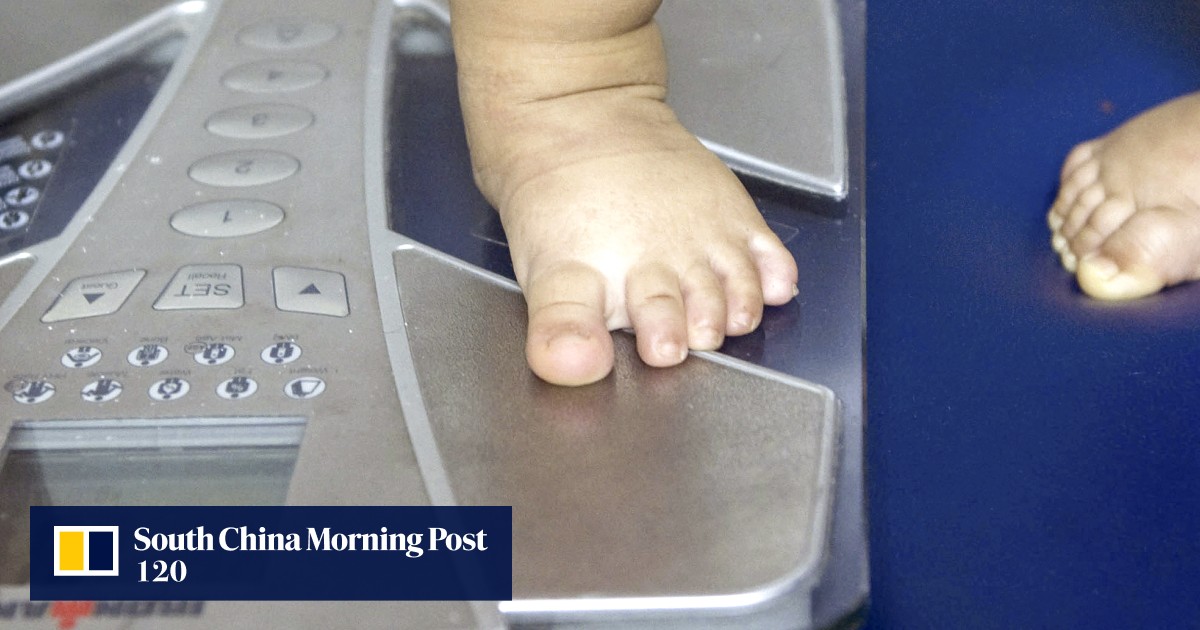 Morbidly obese Texan toddler may be youngest ‘adult-onset’ diabetes ...