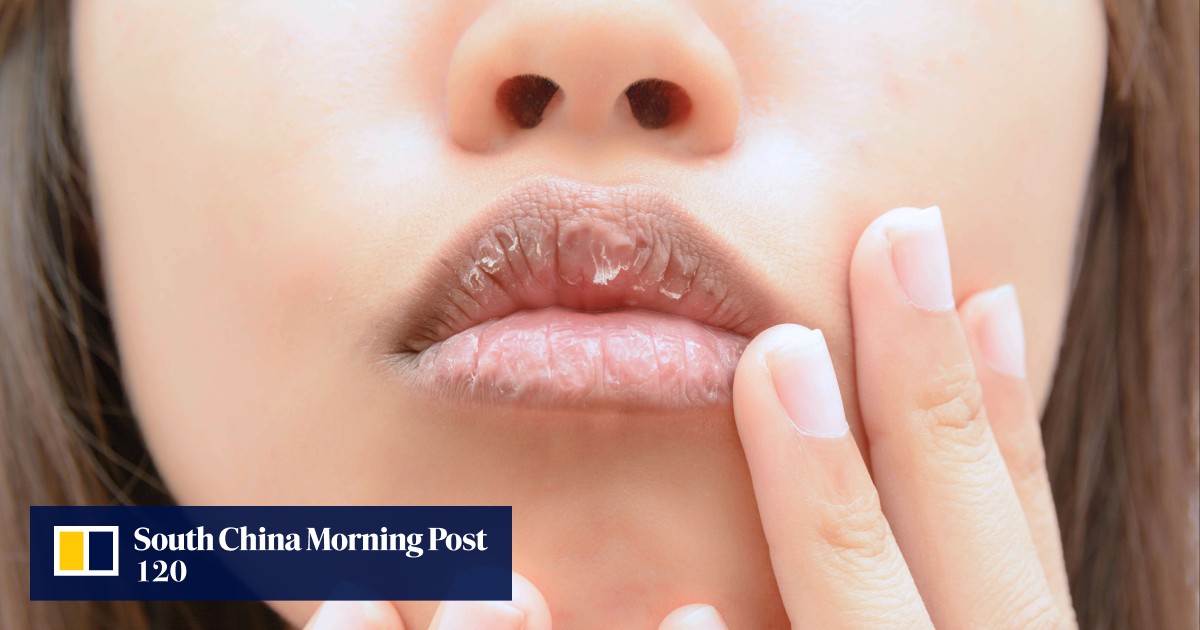 Lip care 101: the products you need for soft, healthy lips – from balms ...