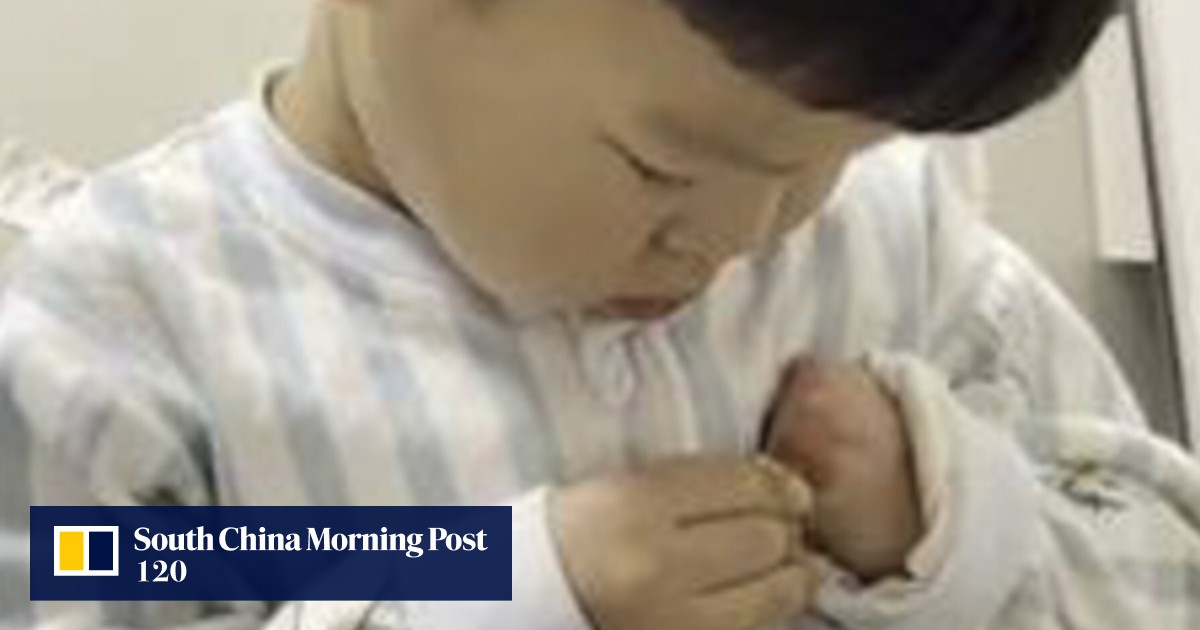 ‘I fought dinosaurs’: Chinese boy, born with no fingers on 1 hand ...
