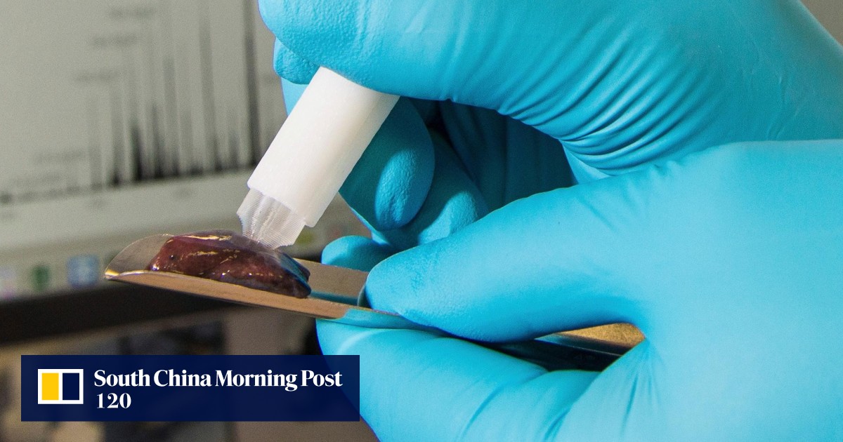 Pencil-sized tool spots cancer cells in seconds, offering safer, more ...